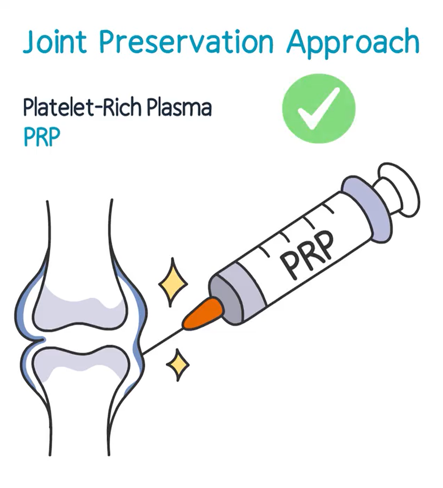 Rethinking Arthritis: The New Joint Preservation Approach | Joint Pain ...